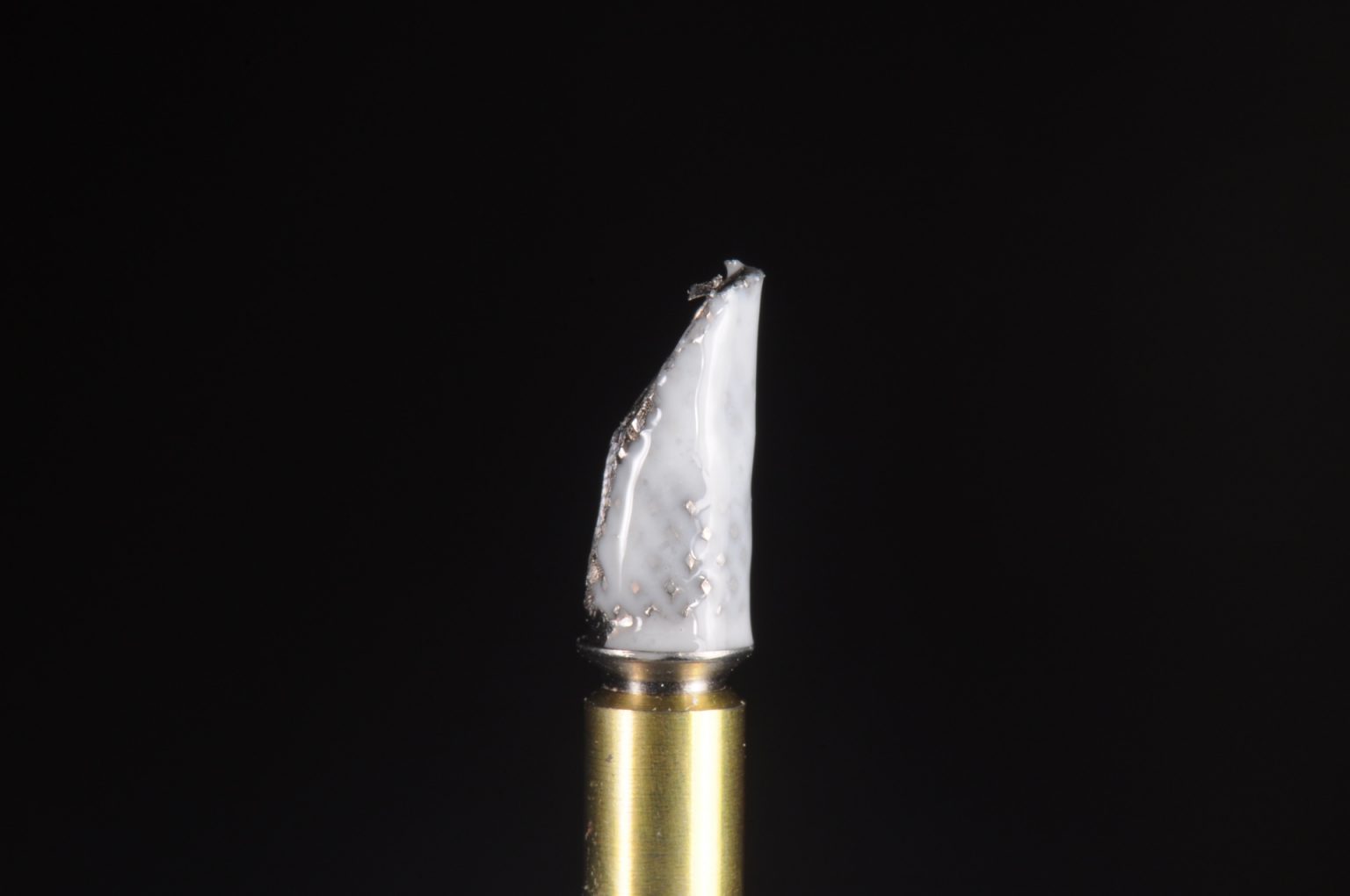 Dental implant-supported transitional prostheses - ITI Blog