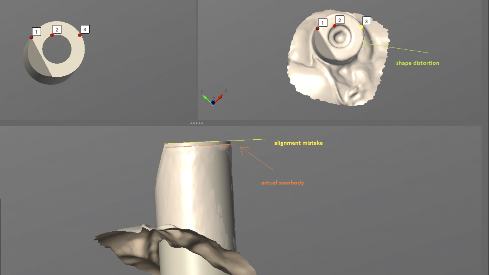 IO scanner as a tool in a surgical practice - ITI Blog