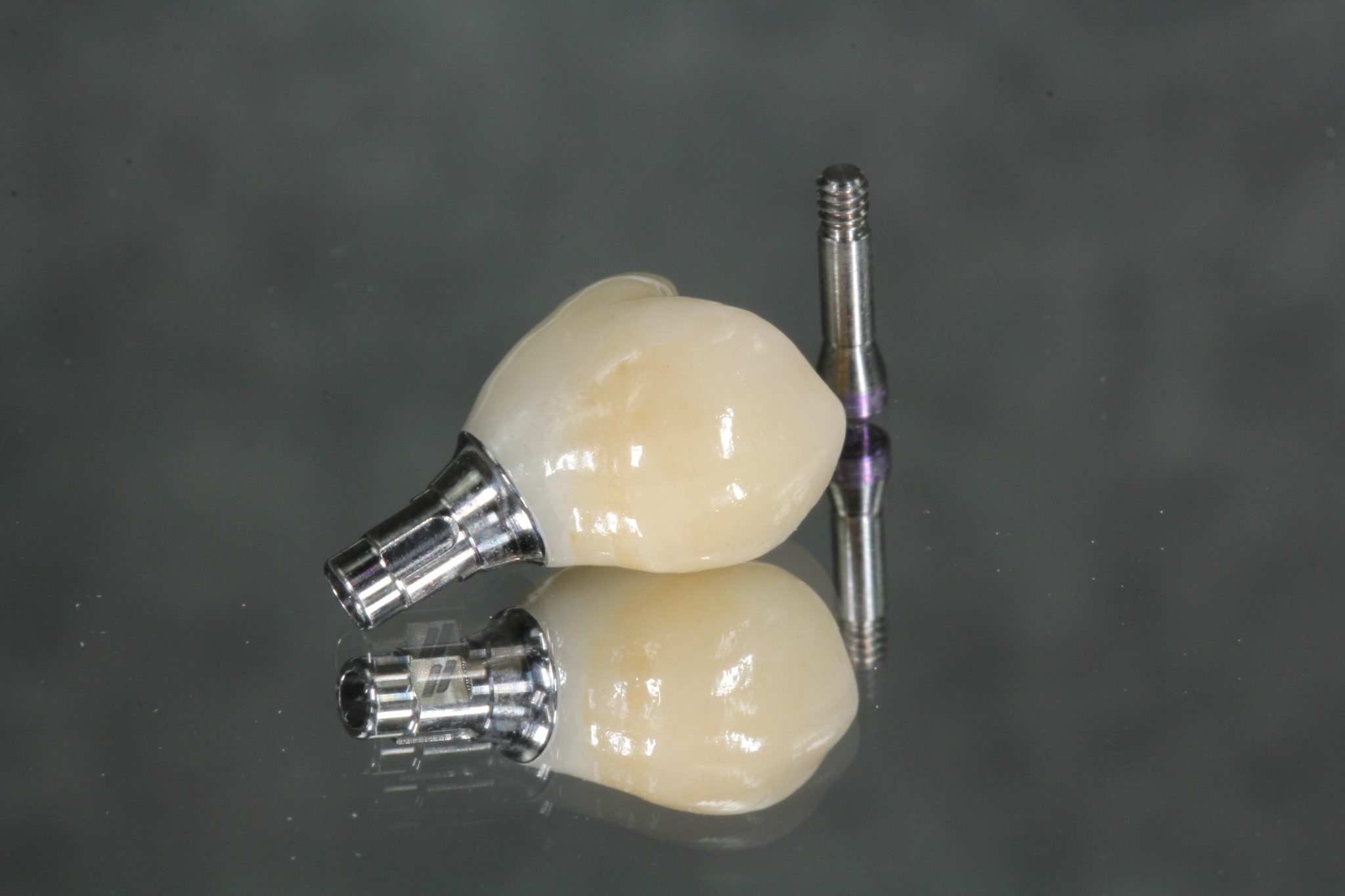 ITI Blog - Clinical applications and advantages of intraoral scanners