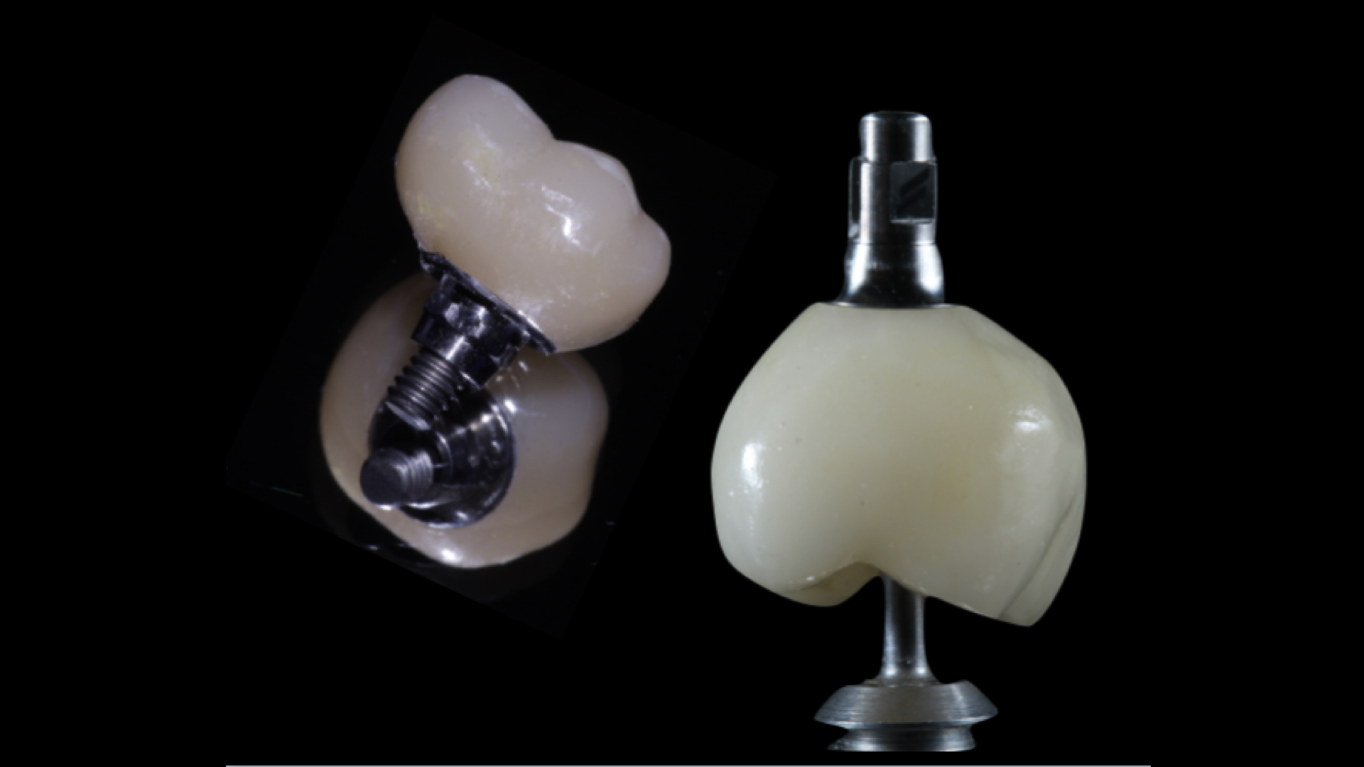 Hybrid abutment-crown for single implant restorations – clinical and ...