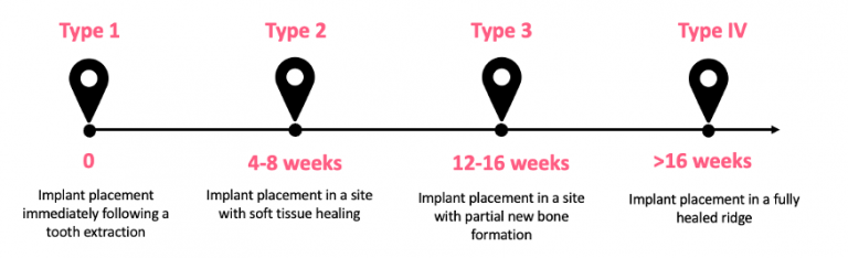 The devil is in the details: case selection for optimal implant ...