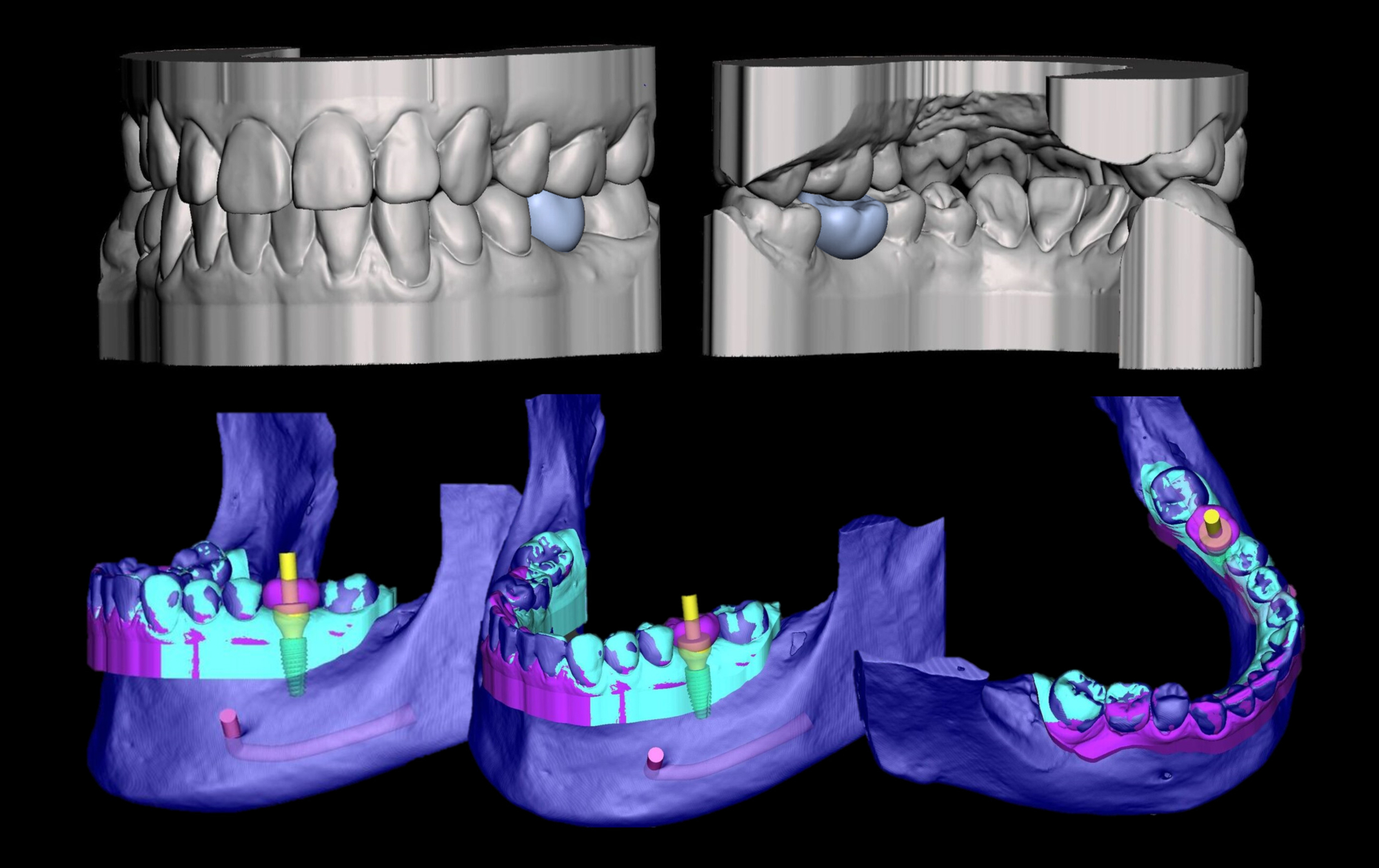 Implementing contemporary digital imaging and CAD-CAM technologies to ...