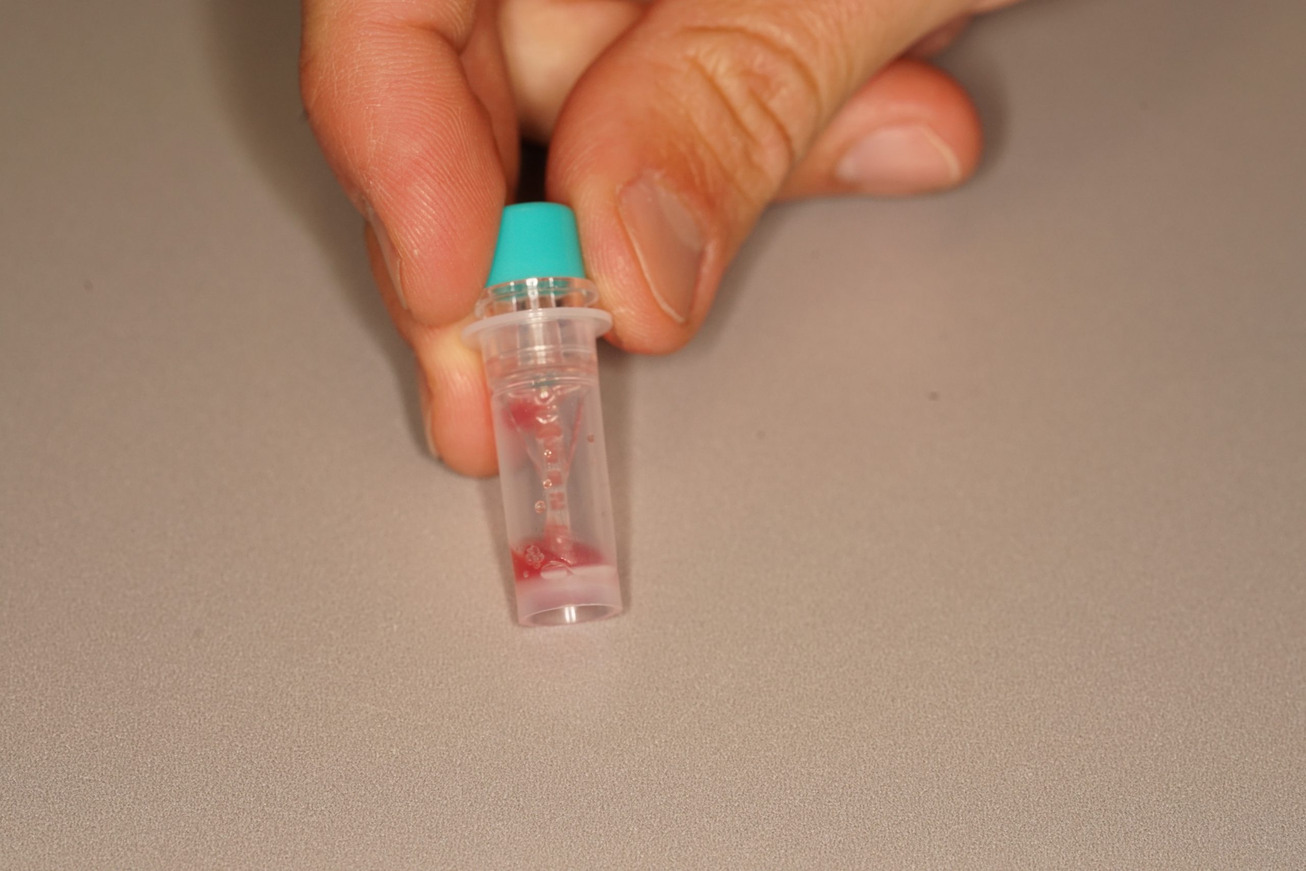 Vitamin D deficiency - Influence of an undersupply on diseases of the ...