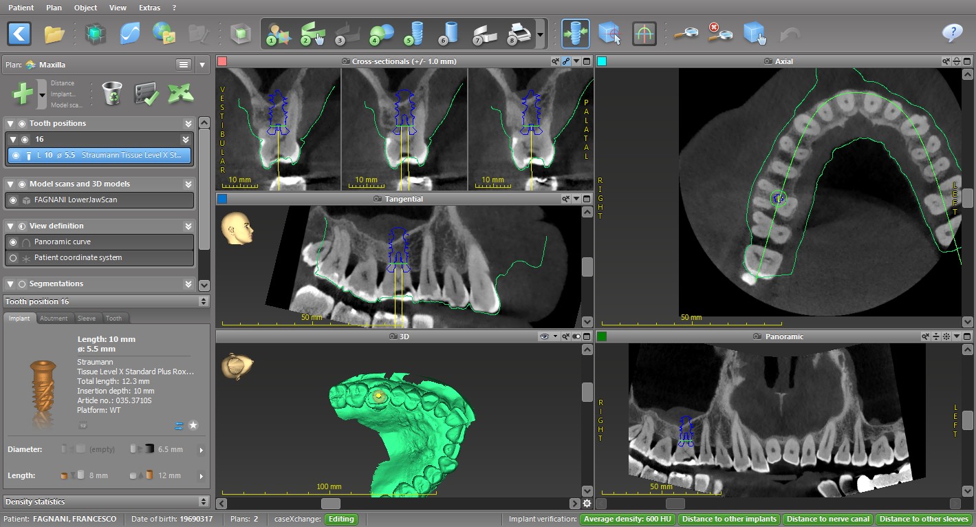 Static, dynamic and robotic technologies in the world of digitally ...