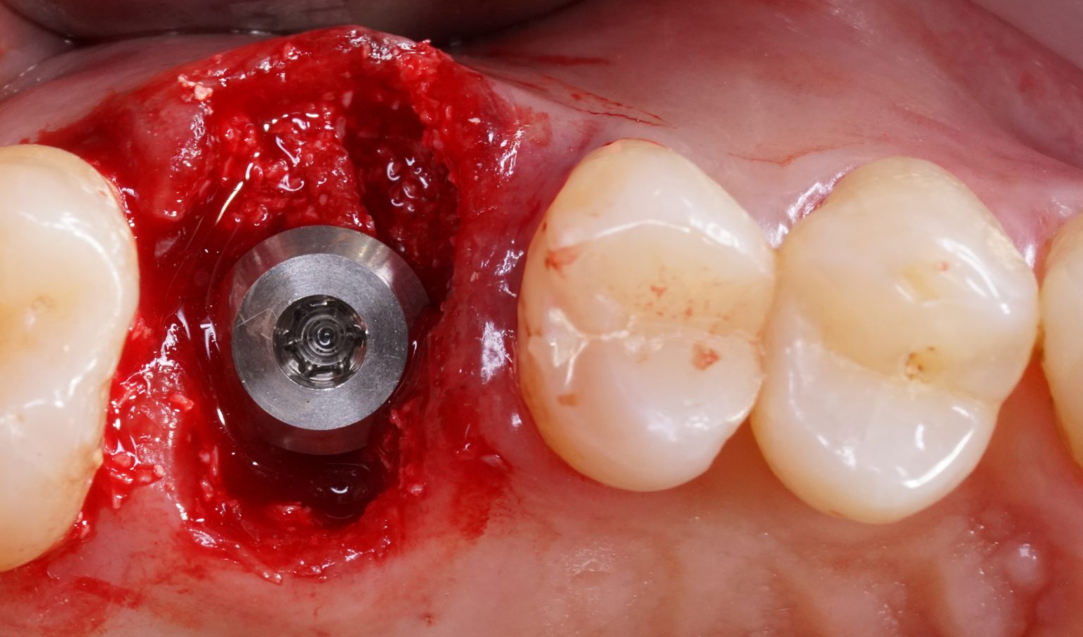Static, dynamic and robotic technologies in the world of digitally ...