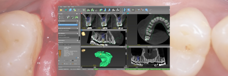 Static, dynamic and robotic technologies in the world of digitally ...