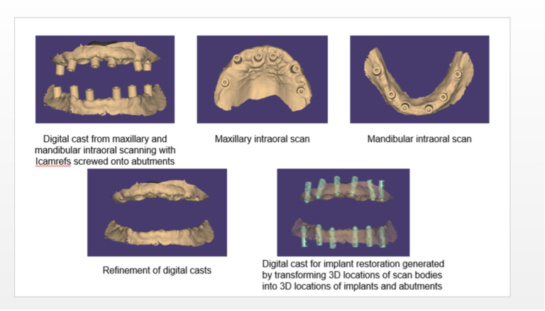 Extra-oral photogrammetry (EPG): Step-by-step workflow guide - ITI Blog